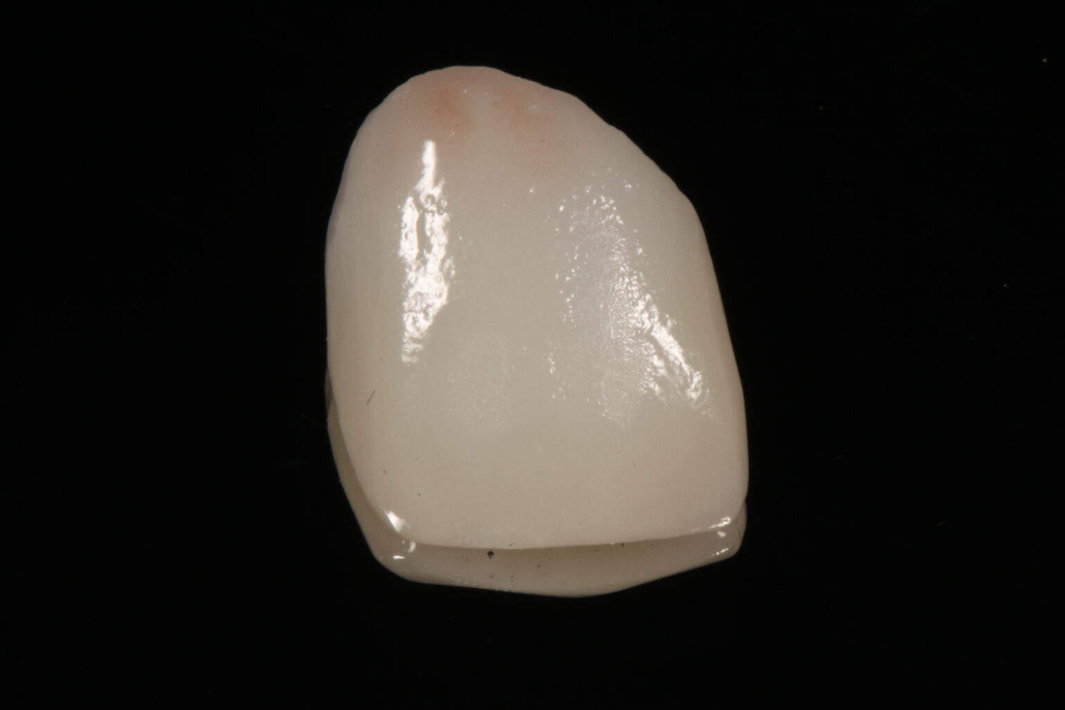 Fixing A Dark Front Tooth | Smile Arts Of NY